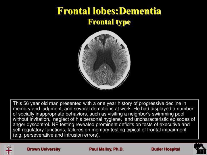 PPT - The Frontal Lobes Function and Dysfunction PowerPoint ...