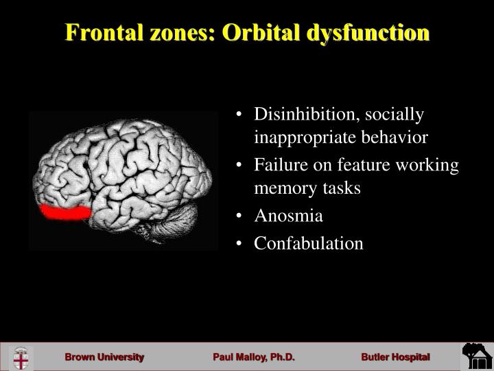 PPT - The Frontal Lobes Function and Dysfunction PowerPoint ...