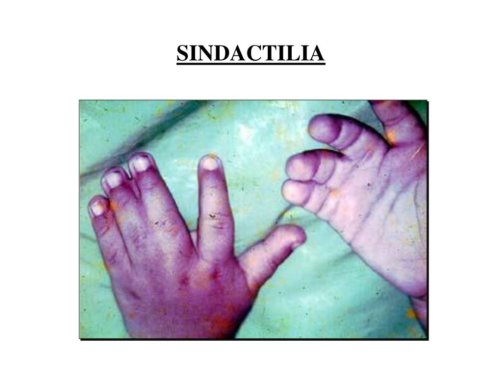 PPT - CURSO DE CIRURGIA PEDIÁTRICA PATOLOGIAS CIRÚRGICAS DIAGNÓSTICO ...