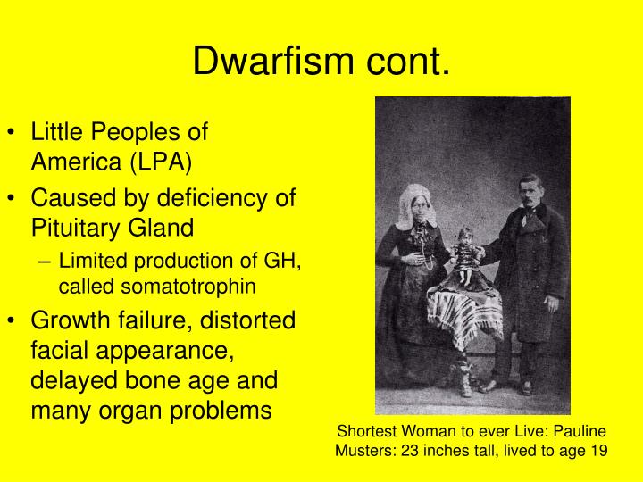 PPT - Dwarfism, Gigantism, and Acromegaly PowerPoint Presentation - ID ...