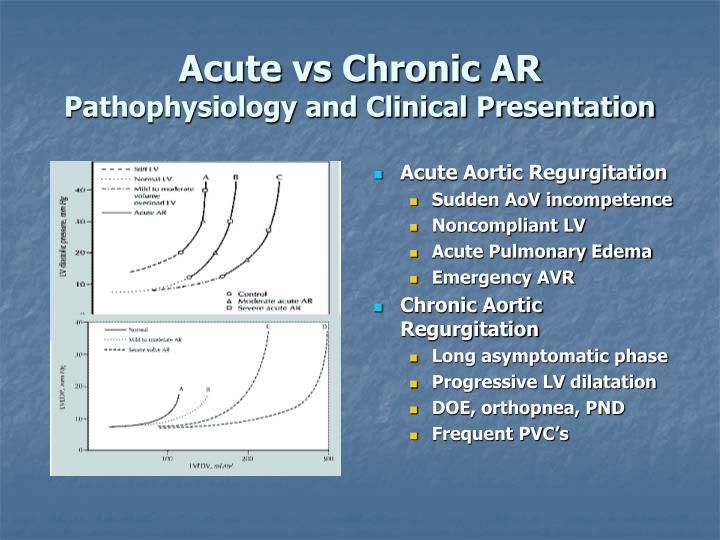 PPT - Valvular Heart Disease PowerPoint Presentation - ID:143464