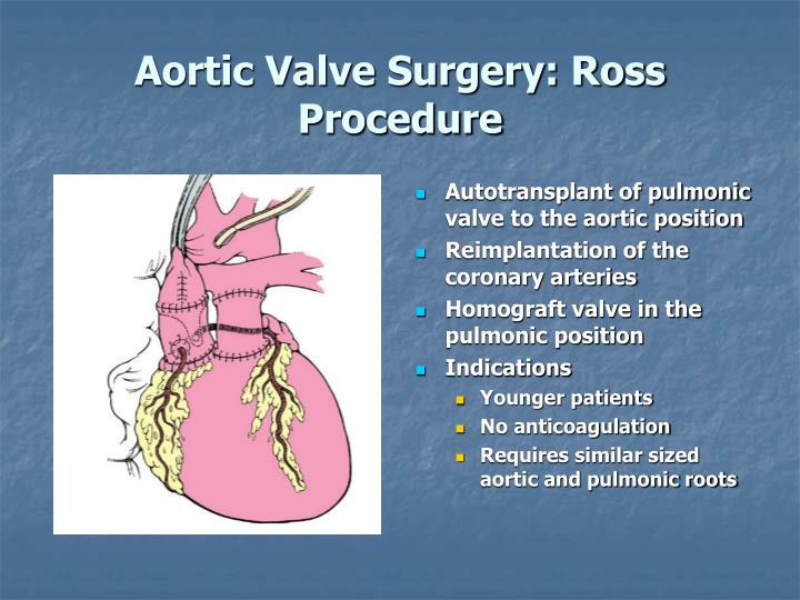 PPT - Valvular Heart Disease PowerPoint Presentation - ID:143464