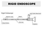 PPT - ENDOSCOPY C O N T E N T S PowerPoint Presentation - ID:1436342