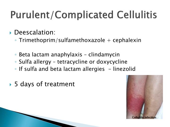 PPT - Inpatient Skin and Soft Tissue Infections PowerPoint Presentation ...