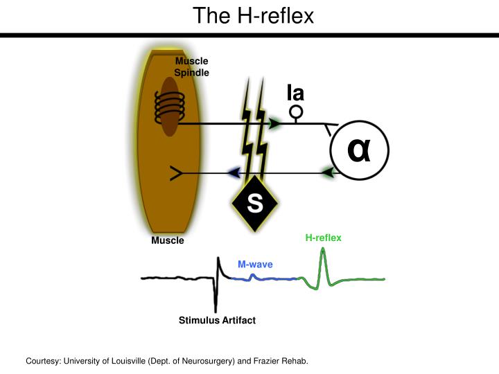 PPT - H-reflex Methods and Significance PowerPoint Presentation - ID ...