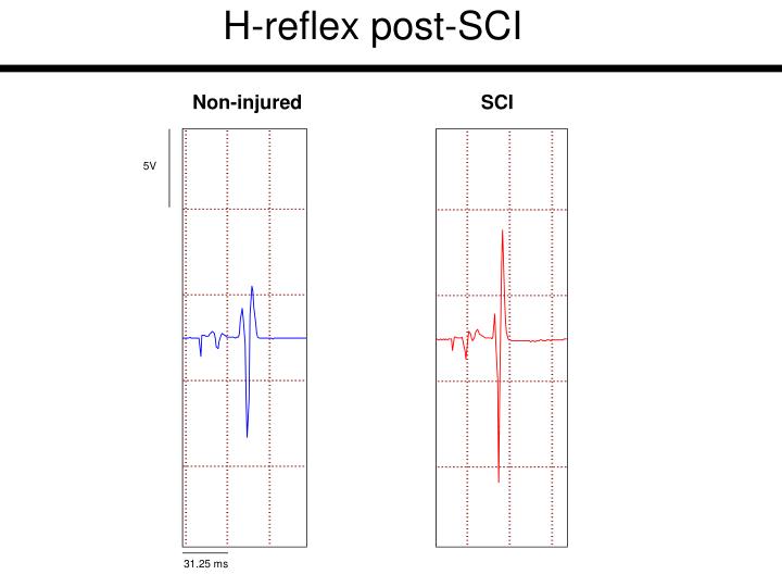 PPT - H-reflex Methods and Significance PowerPoint Presentation - ID ...