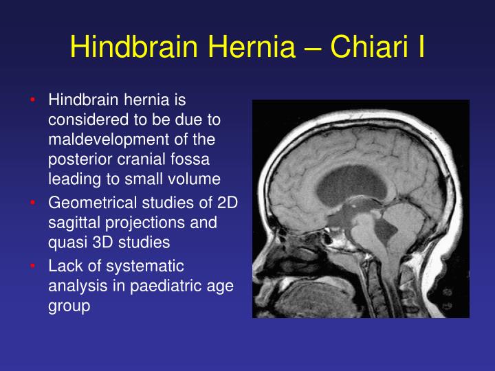 PPT - Posterior Fossa Volume and Skull Base Geometry in Children with ...