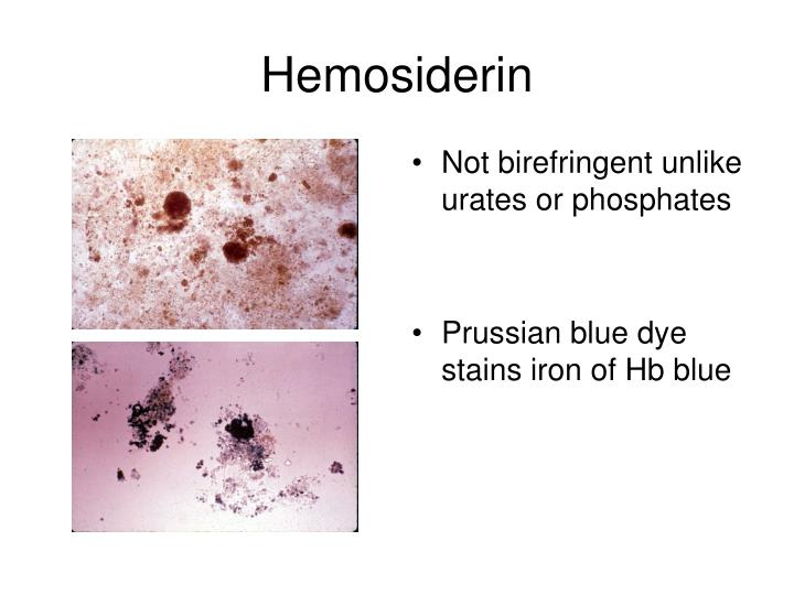 PPT - Urinalysis Tidbits PowerPoint Presentation - ID:1444231