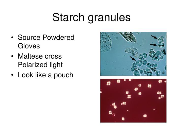 PPT - Urinalysis Tidbits PowerPoint Presentation - ID:1444231