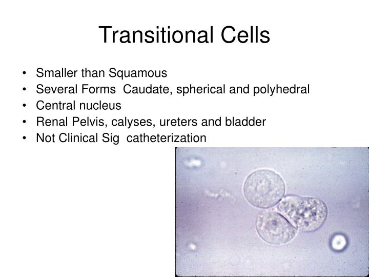 PPT - Urinalysis Tidbits PowerPoint Presentation - ID:1444231