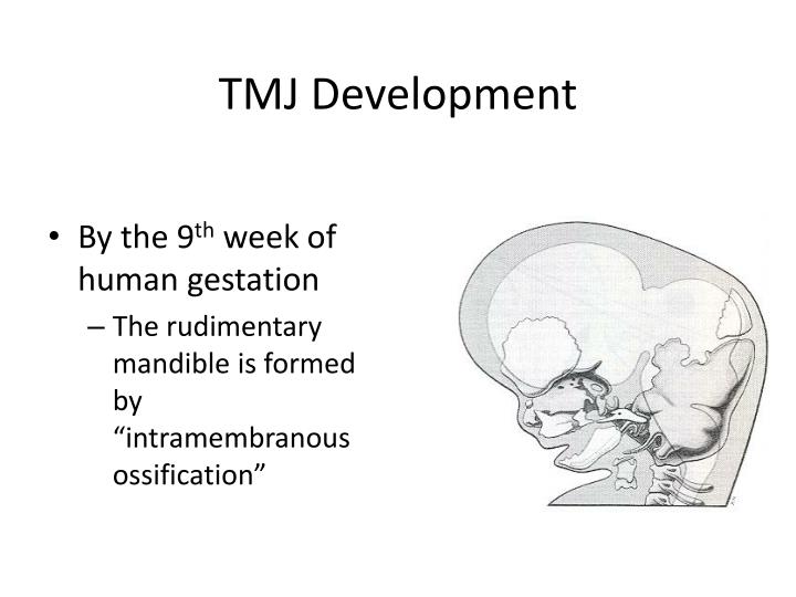 PPT - Management of TMJ disorders PowerPoint Presentation - ID:1444815