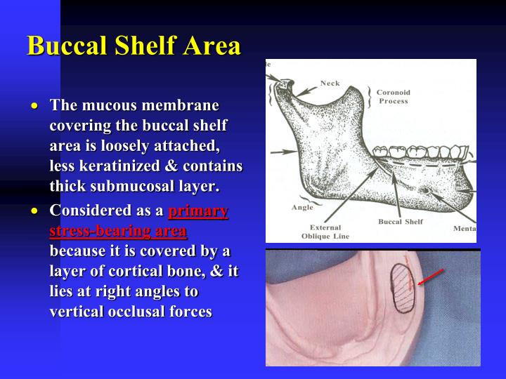 PPT - Anatomy of Mandibular Denture Bearing Area PowerPoint ...