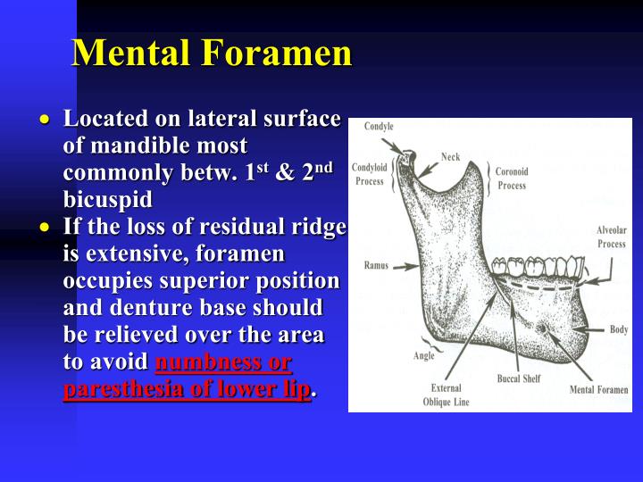 PPT - Anatomy of Mandibular Denture Bearing Area PowerPoint ...