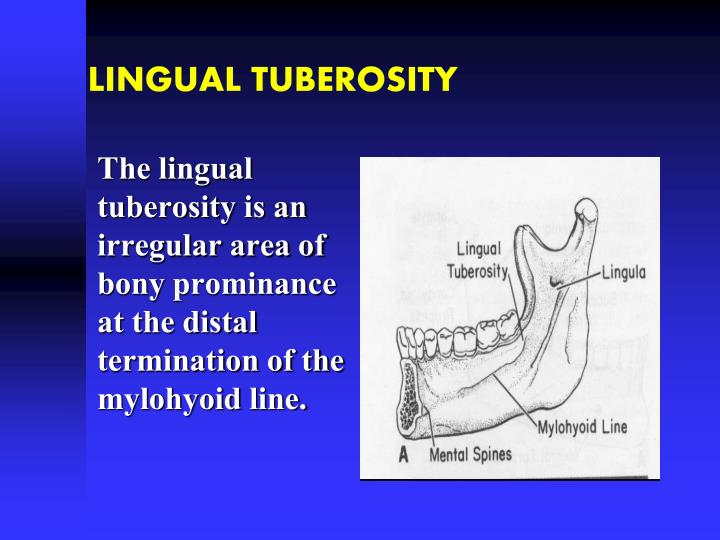 PPT - Anatomy of Mandibular Denture Bearing Area PowerPoint ...