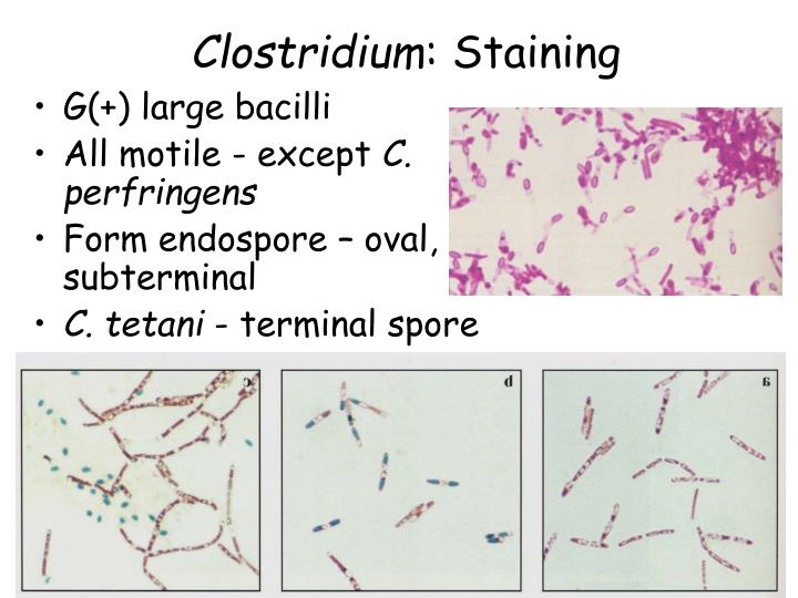 PPT - The Anaerobes PowerPoint Presentation - ID:1445854