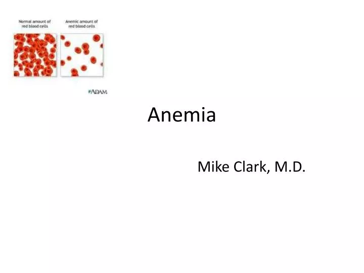PPT - Anemia PowerPoint Presentation, free download - ID:1450406