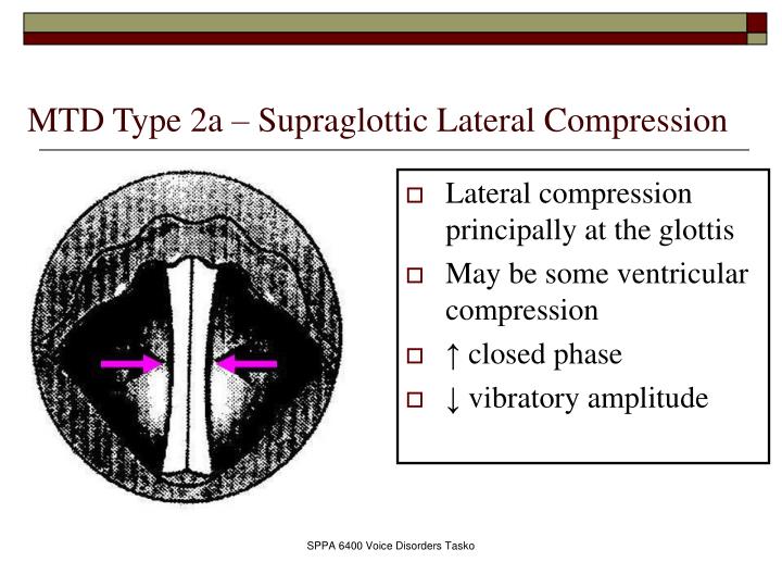 PPT - Functional Dysphonia/ Muscle Tension Dysphonia (MTD) PowerPoint ...