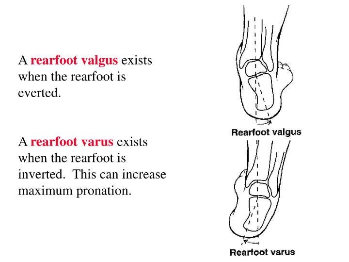 Ppt Midtarsal Joint Between Calcaneus And Cuboid On Lateral Side Between Talus And Navicular