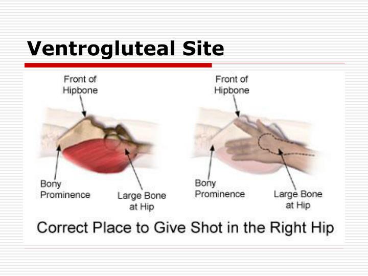 PPT - Intramuscular Injection PowerPoint Presentation - ID:1452695