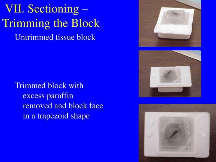PPT - Tissue Processing PowerPoint Presentation - ID:1455886