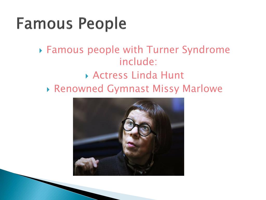 Ppt Turner Syndrome Powerpoint Presentation Free Download Id 1457293