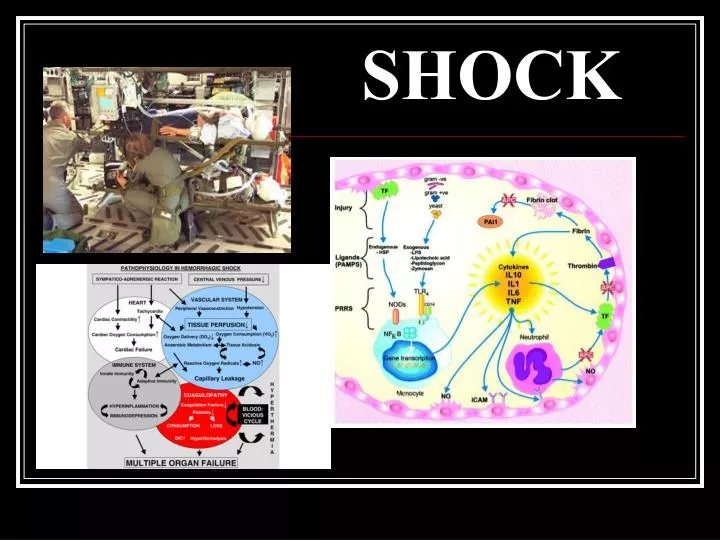PPT - SHOCK PowerPoint Presentation, free download - ID:1458319
