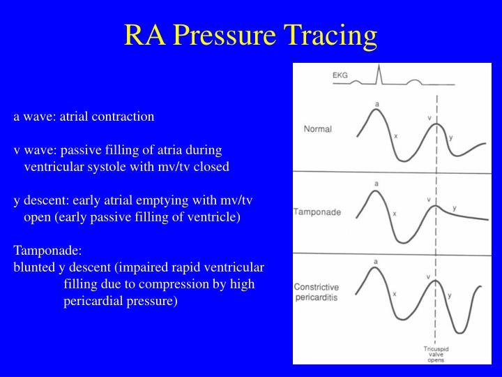 PPT - Pathophysiology of Pericardial Disease IMS 350 PowerPoint ...