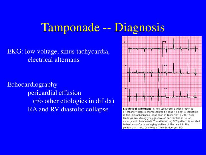 PPT - Pathophysiology of Pericardial Disease IMS 350 PowerPoint ...