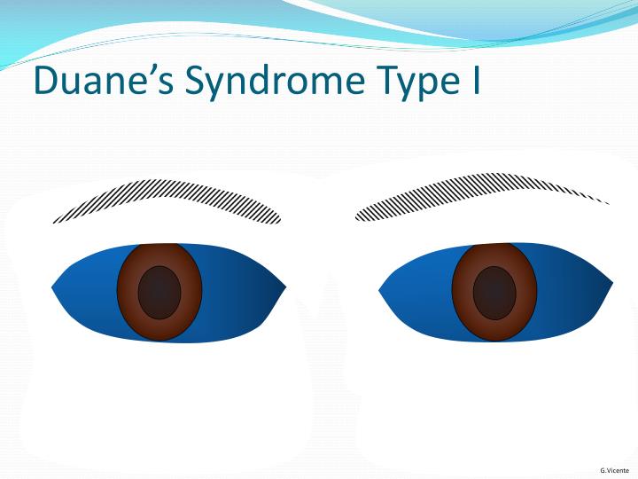PPT - Strabismus for 5 th yr medical students PowerPoint Presentation ...