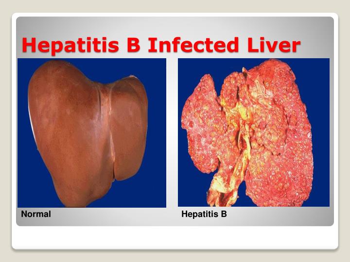 PPT - Bloodborne Pathogens PowerPoint Presentation - ID:1463472