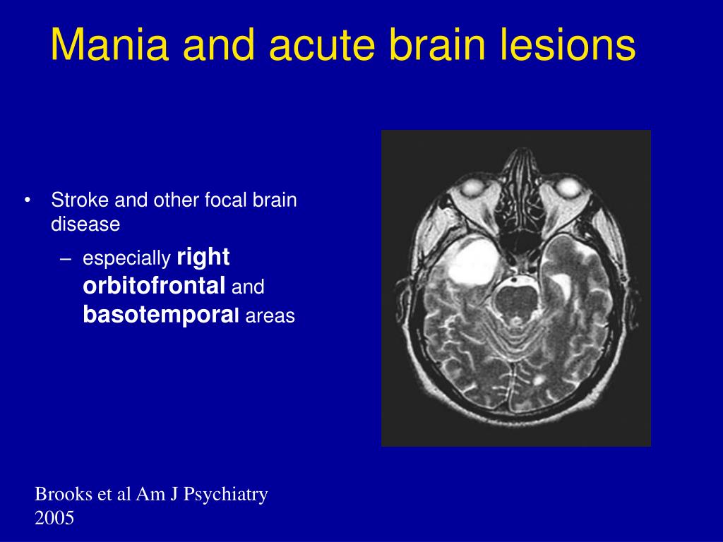 PPT - Robert Kelly, MD Assistant Professor of Psychiatry Weill Cornell ...