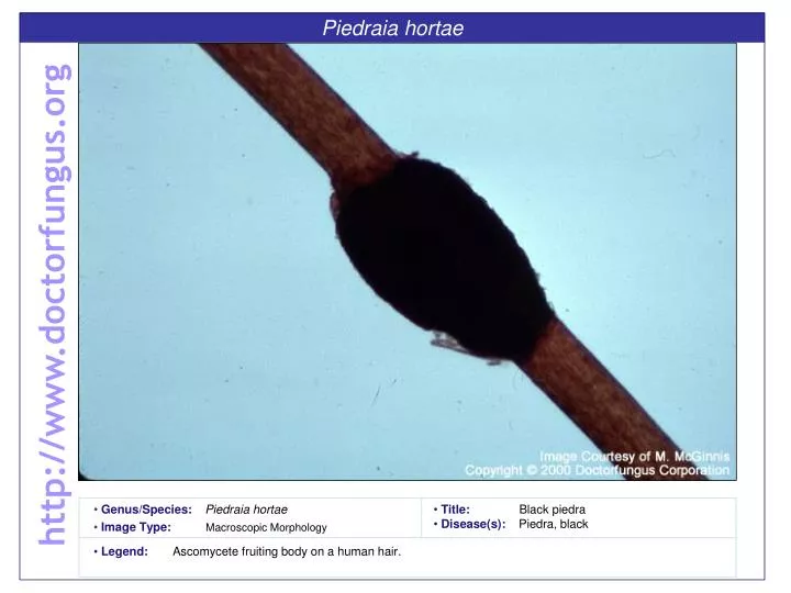 Piedraia hortae ~ Everything You Need to Know with Photos | Videos