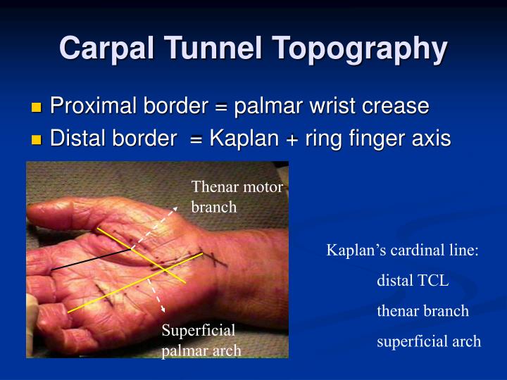 PPT - Carpal Tunnel Syndrome PowerPoint Presentation - ID:148542