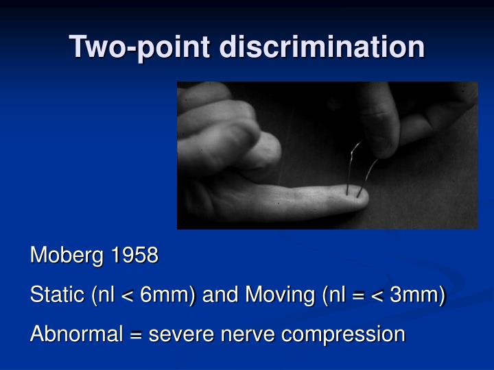 PPT - Carpal Tunnel Syndrome PowerPoint Presentation - ID:148542