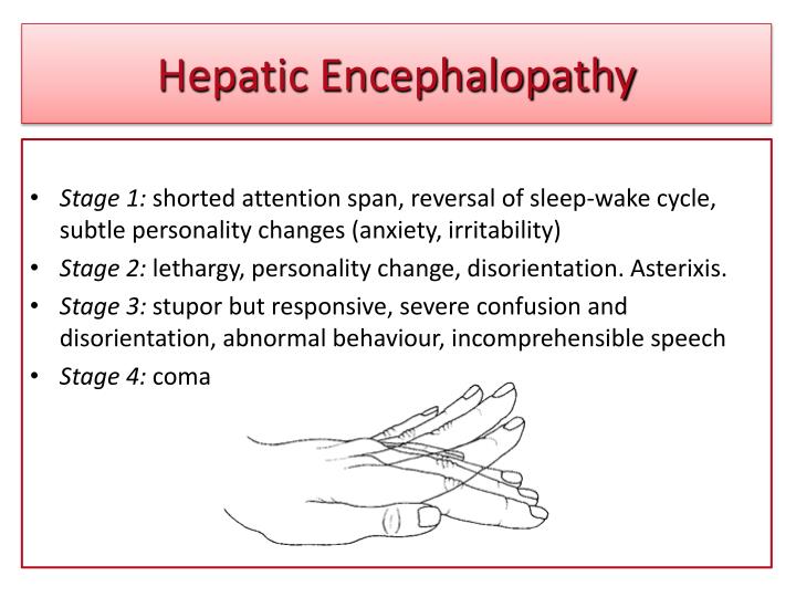 PPT - Chronic Liver Disease PowerPoint Presentation - ID:1485423