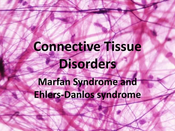 PPT - Connective Tissue Disorders PowerPoint Presentation, free ... PPT - Connective Tissue Disorders PowerPoint Presentation, free ...