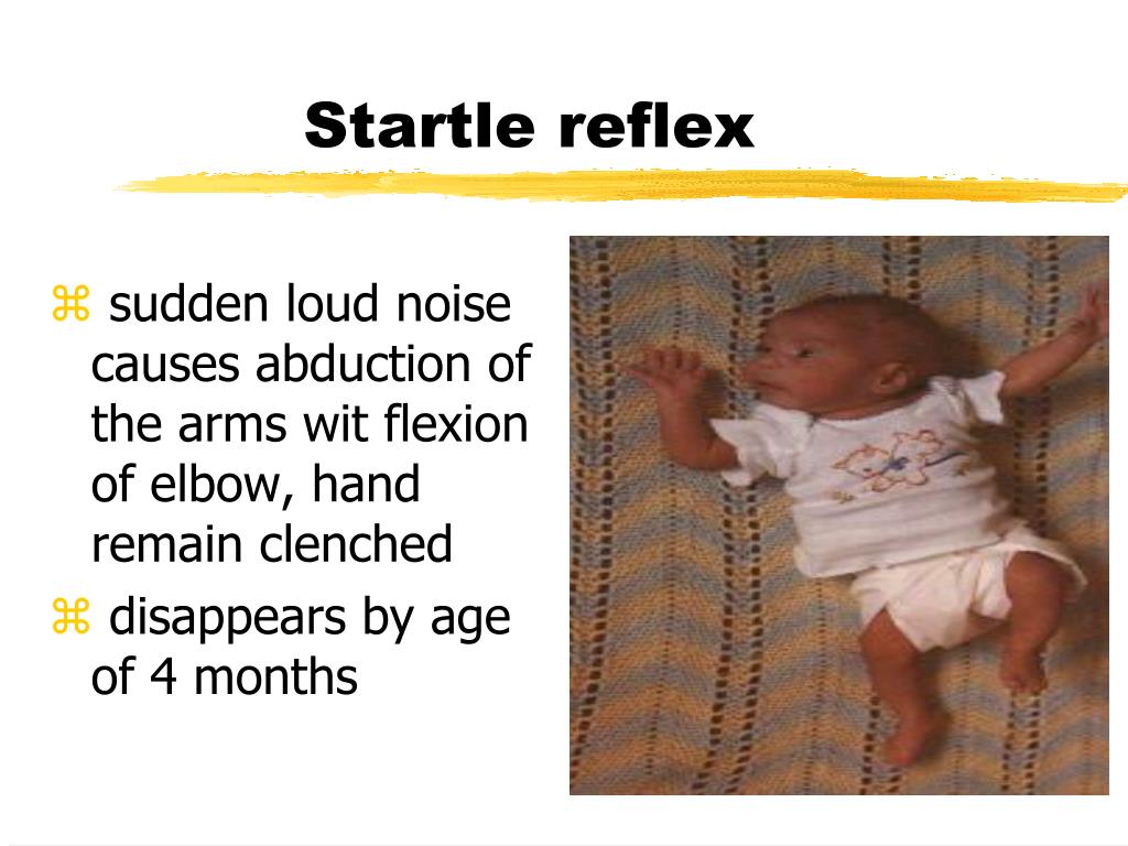 What Is Startle Reflex Baby At Ida Whitford Blog