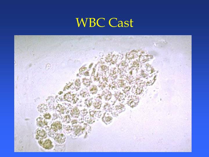 PPT - ACUTE RENAL FAILURE PowerPoint Presentation - ID:1487123