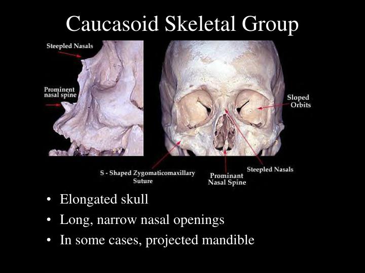 PPT - Identification of Human Remains PowerPoint Presentation - ID:1487312