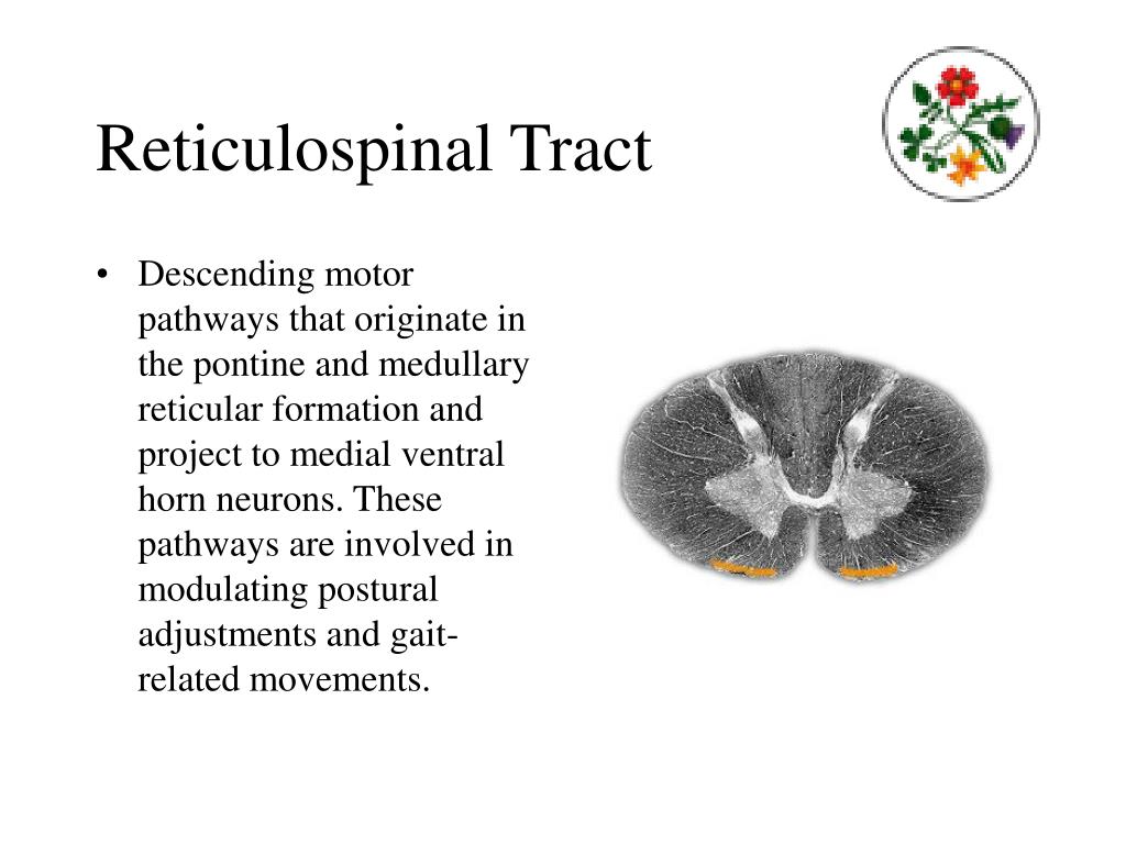 PPT - Case Study of a stroke patient. The National Hospital for ...