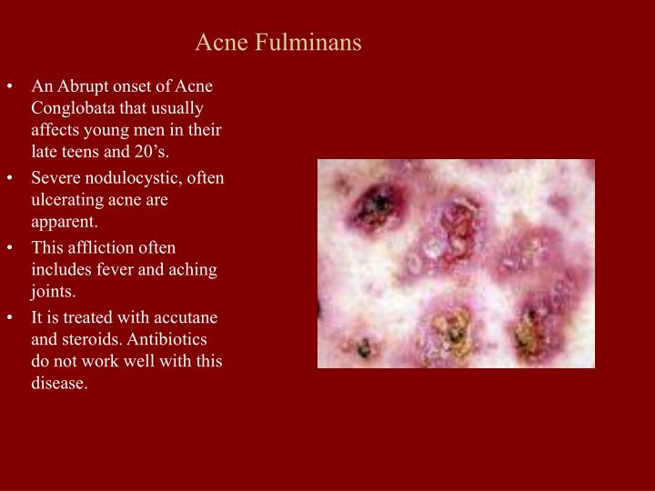 PPT - The Integumentary System PowerPoint Presentation - ID:151207