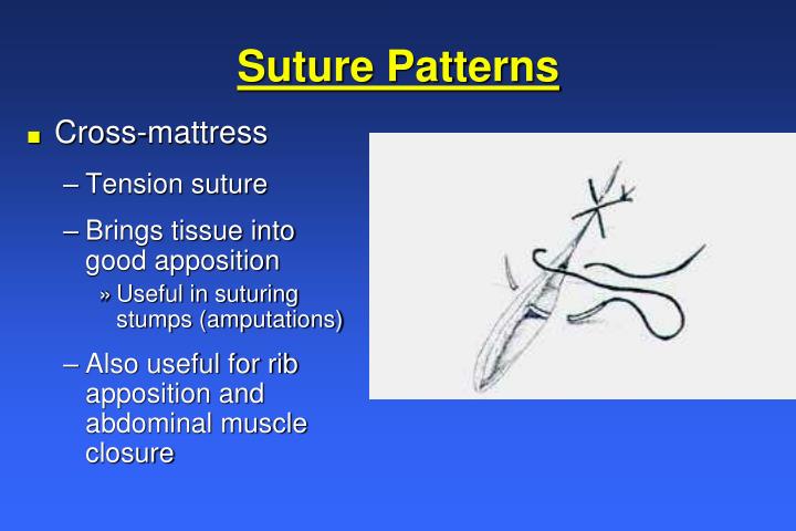 PPT - Wound Healing and Suture Knowledge PowerPoint Presentation - ID ...