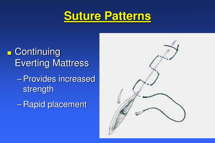 PPT - Wound Healing and Suture Knowledge PowerPoint Presentation - ID:155623
