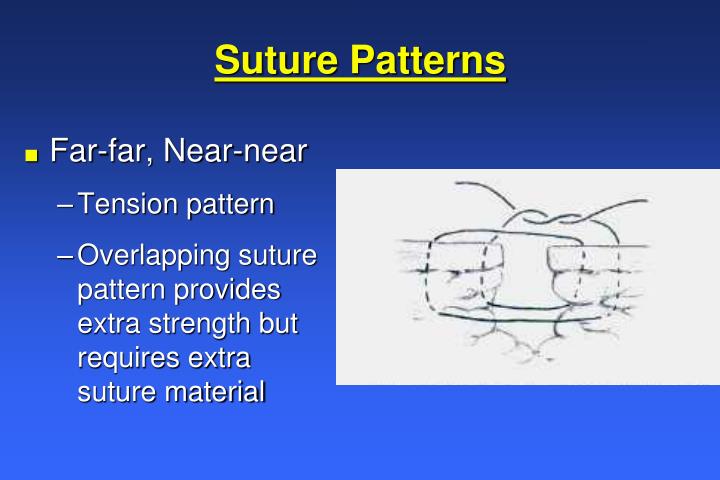PPT - Wound Healing and Suture Knowledge PowerPoint Presentation - ID ...