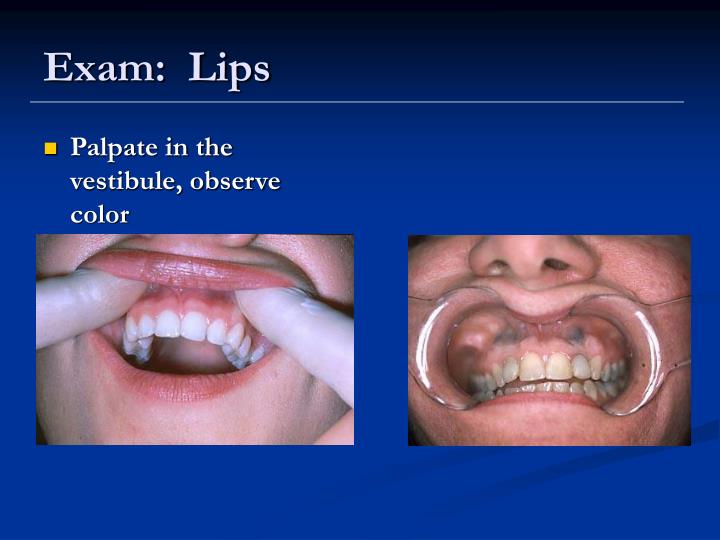 PPT - Examination of the Oral Cavity PowerPoint Presentation - ID:156291