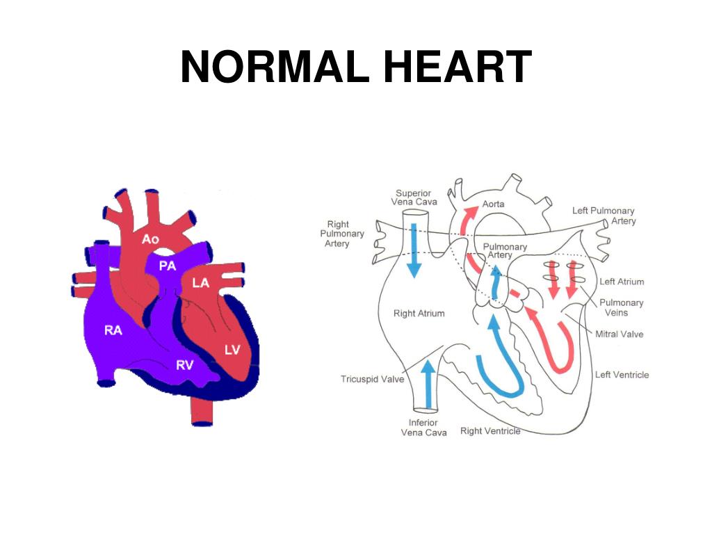PPT - RSPT 2353 Neonatal Pediatric Respiratory Care PowerPoint ...