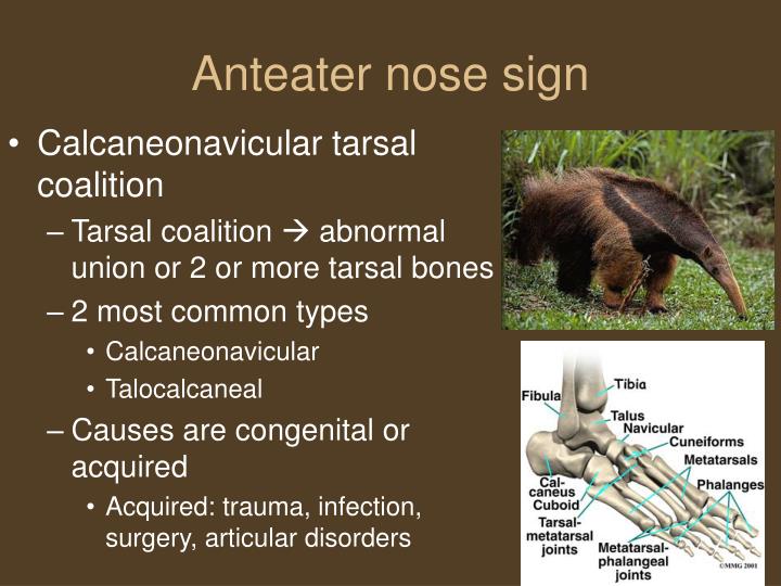 PPT - Seeing the signs of Radiology PowerPoint Presentation - ID:158707