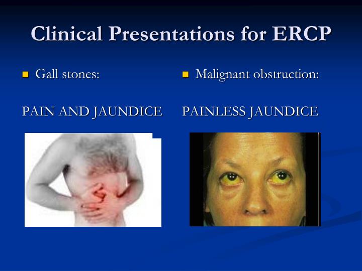 PPT - ERCP PowerPoint Presentation - ID:161720