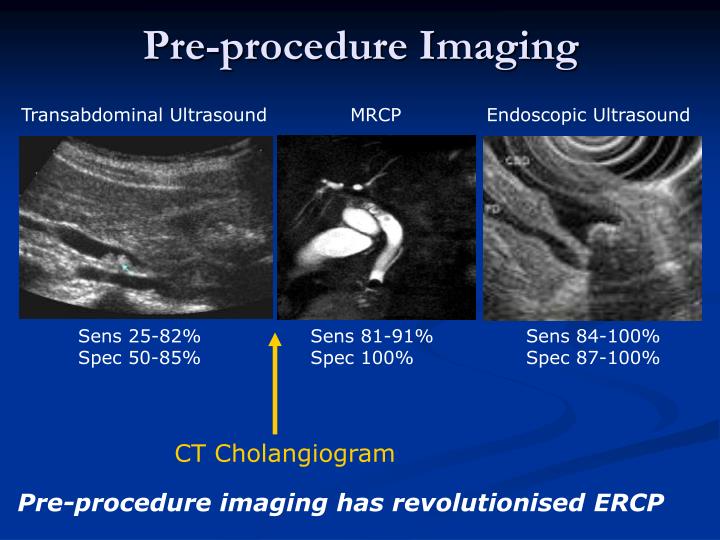PPT - ERCP PowerPoint Presentation - ID:161720
