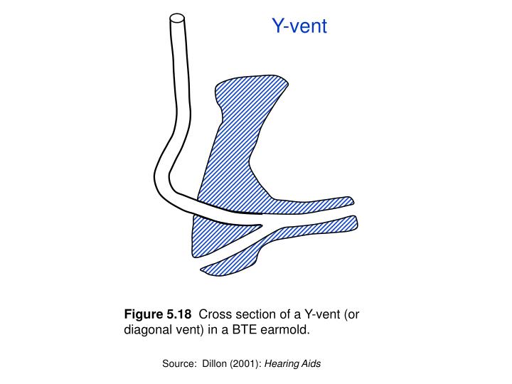 PPT - Figures for Chapter 5 Earmolds and earshells PowerPoint ...